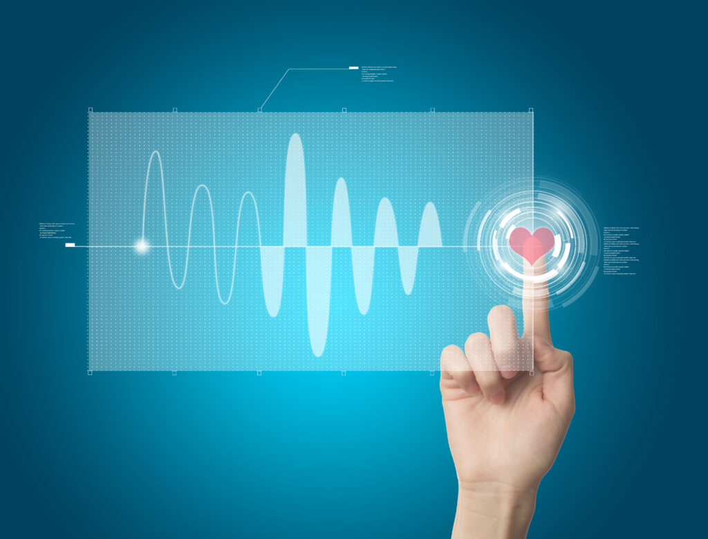 New radar technology advances heart rhythm detection | Digital Watch ...